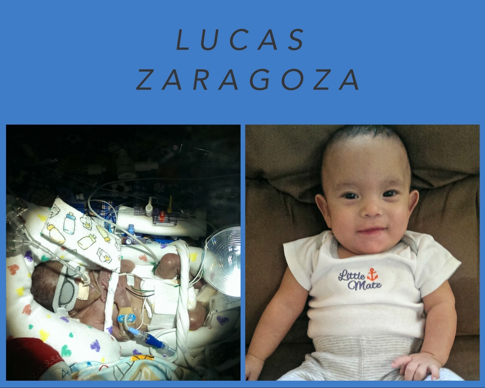 Small Baby Unit Before and After - CHOC - Children's Health Hub