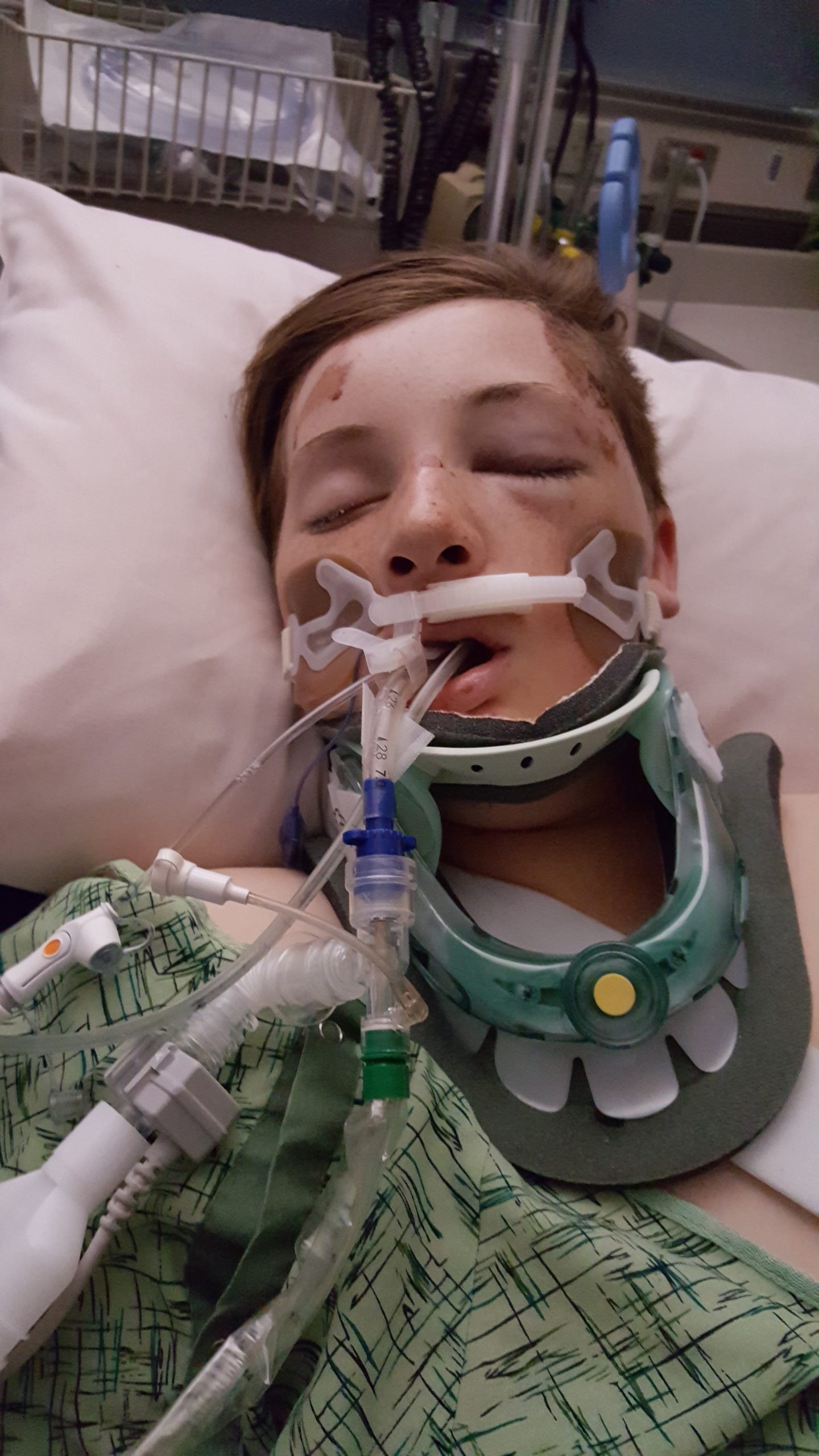 How a car accident changed my life, by Jacob Werkmeister