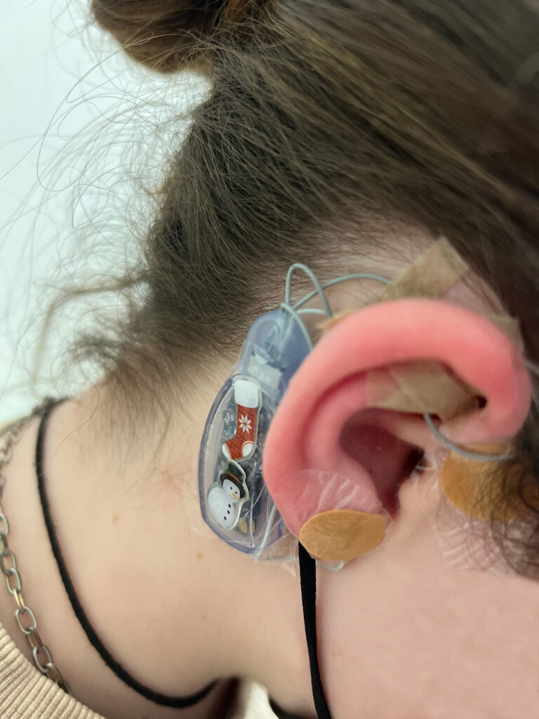 SIBO and IB-Stim: Amelie’s road back to enjoying food - CHOC - Children ...