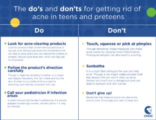 The do's and don'ts of acne prevention - CHOC - Children's Health Hub