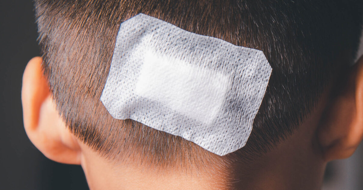 Tips For Minimizing Scars After Surgery Choc Radio Tips For