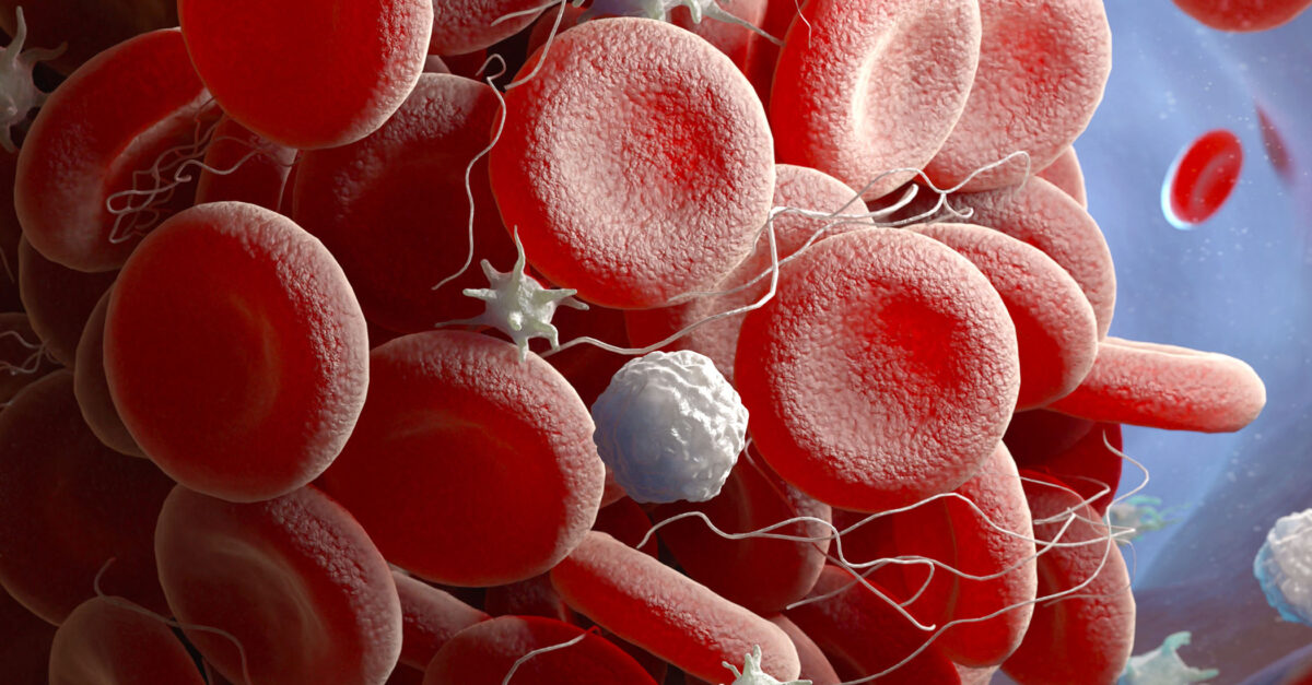 Venous Thromboembolism: Is My Child at Risk? - CHOC - Children's Health Hub