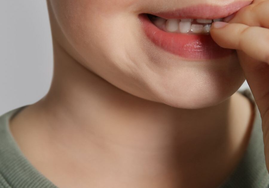 Navigating selective mutism in children - CHOC - Children's Health Hub
