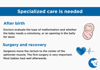 Anorectal malformation explained: What families need to know - CHOC ...