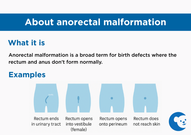 Anorectal malformation explained: What families need to know - CHOC ...